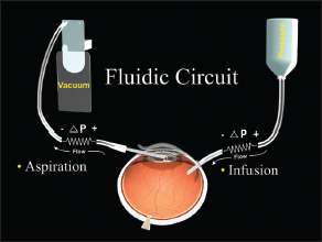 Retinal Physician | PentaVision