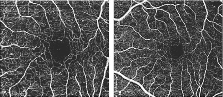 Retinal Physician | PentaVision