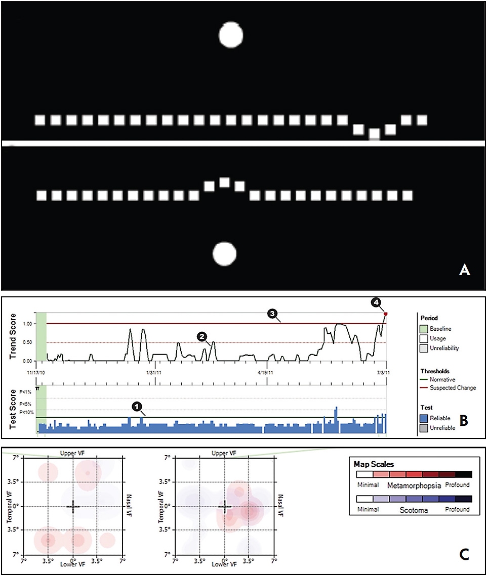 Retinal Physician | PentaVision