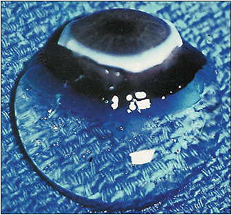 Retinal Physician | PentaVision