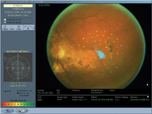 Retinal Physician | PentaVision