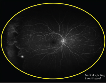 Retinal Physician | PentaVision