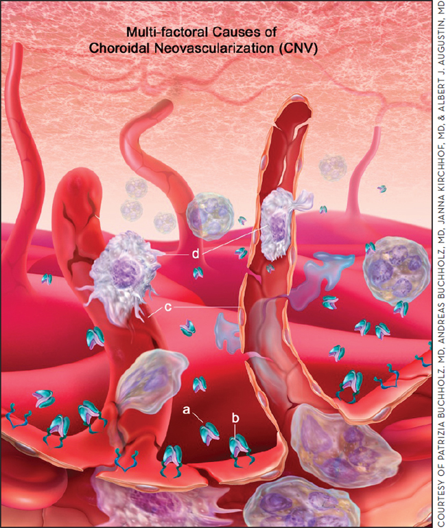 Retinal Physician | PentaVision