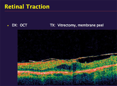 Retinal Physician | PentaVision
