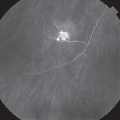 Retinal Physician | PentaVision