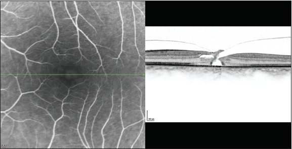 Retinal Physician | PentaVision