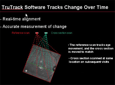 Retinal Physician | PentaVision