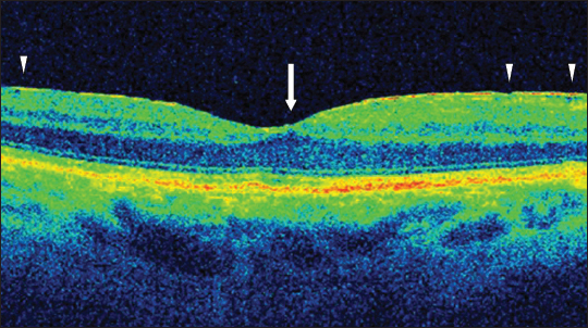 Retinal Physician | PentaVision