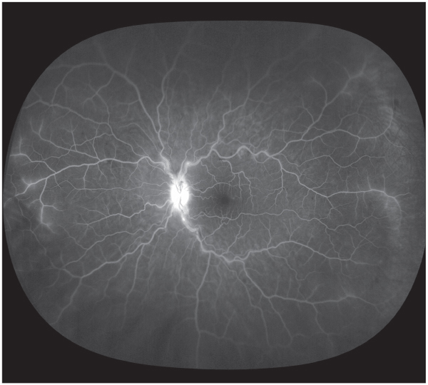 Retinal Physician | PentaVision