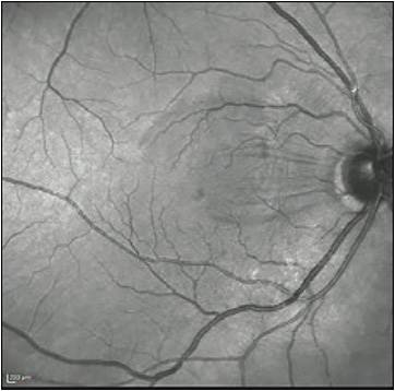 Retinal Physician | PentaVision