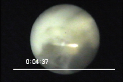 Retinal Physician | PentaVision