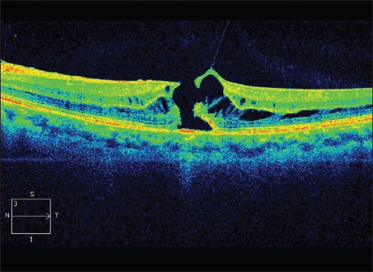 Retinal Physician | PentaVision