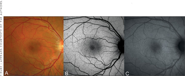 Retinal Physician | PentaVision