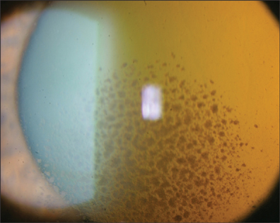 Retinal Physician | PentaVision