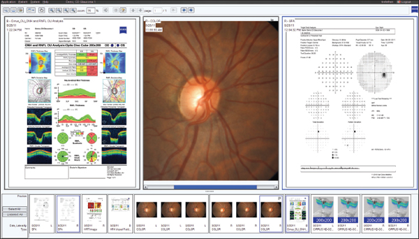 Retinal Physician | PentaVision