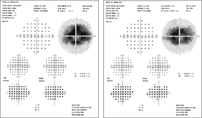 Retinal Physician | PentaVision