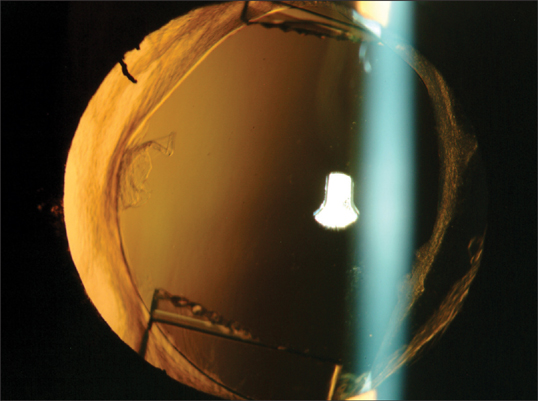 Retinal Physician | PentaVision