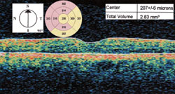 Retinal Physician | PentaVision