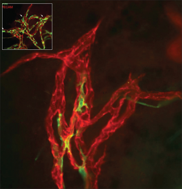 Retinal Physician | PentaVision