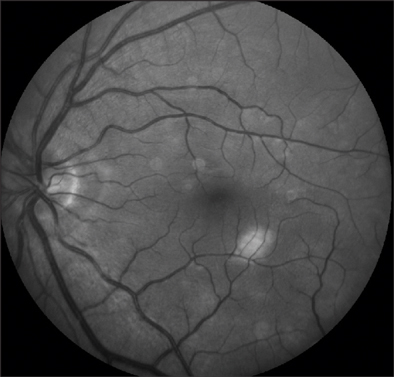 Retinal Physician | PentaVision