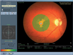Retinal Physician | PentaVision