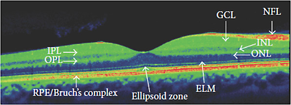 Retinal Physician | PentaVision
