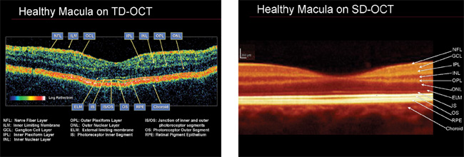Retinal Physician | PentaVision
