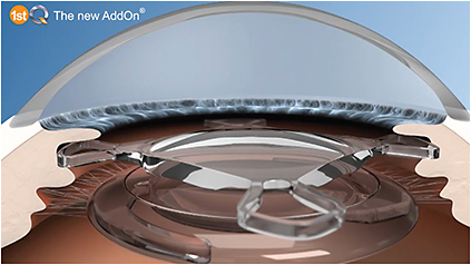 Retinal Physician | PentaVision