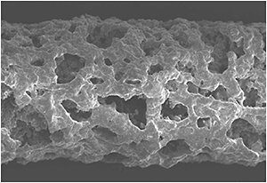 Retinal Physician | PentaVision