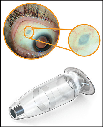 Retinal Physician | PentaVision
