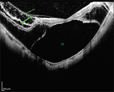 Retinal Physician | PentaVision