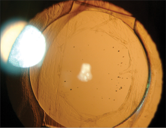 Retinal Physician | PentaVision