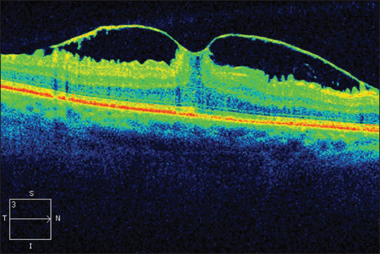 Retinal Physician | PentaVision