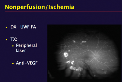 Retinal Physician | PentaVision