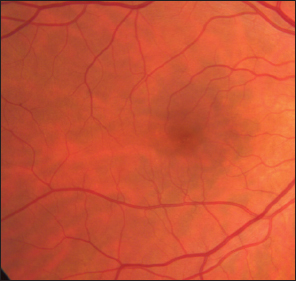 Retinal Physician | PentaVision