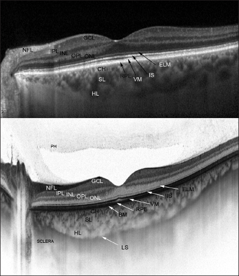 Retinal Physician | PentaVision