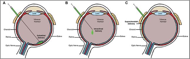 Retinal Physician | PentaVision