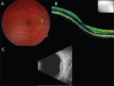 Retinal Physician | PentaVision