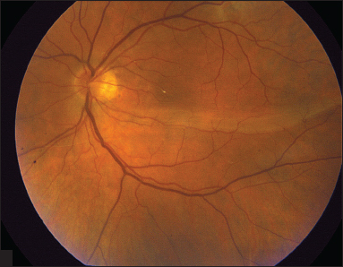 Retinal Physician | PentaVision